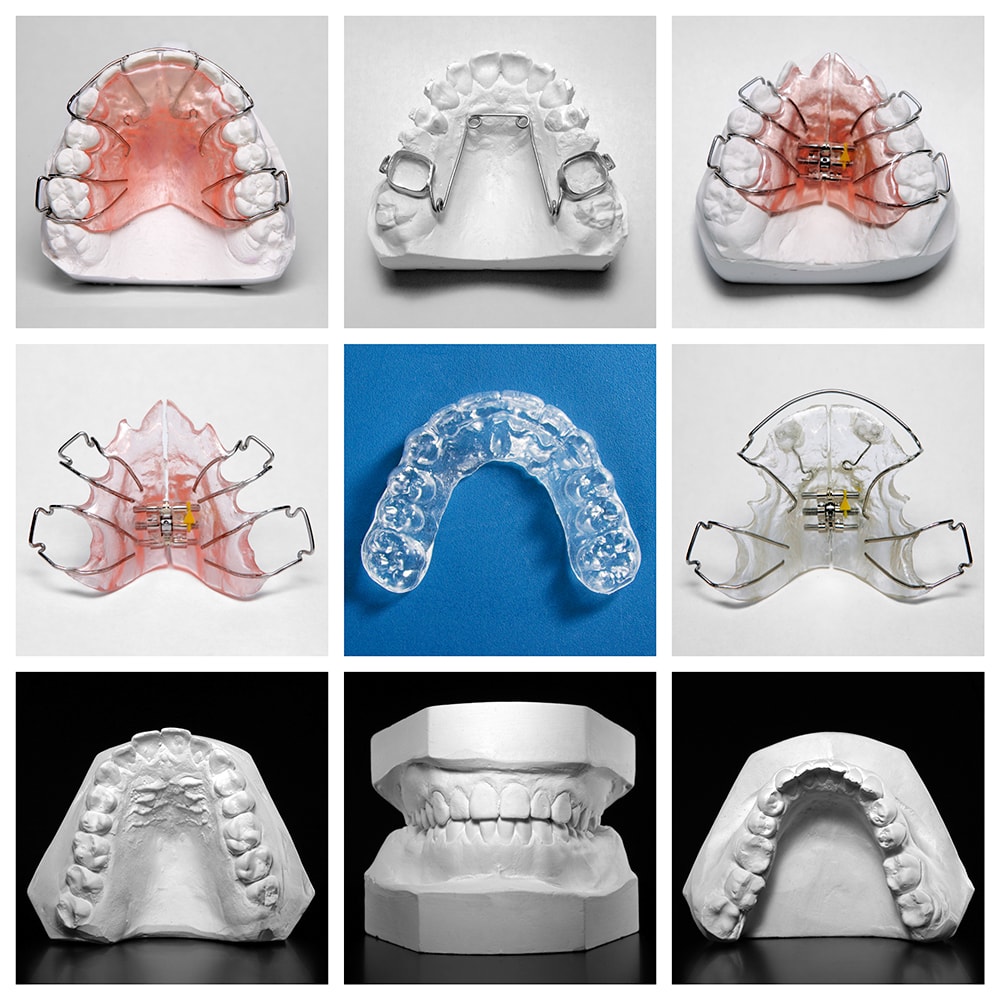 Orthodontics Retainers orthodontics-retainers